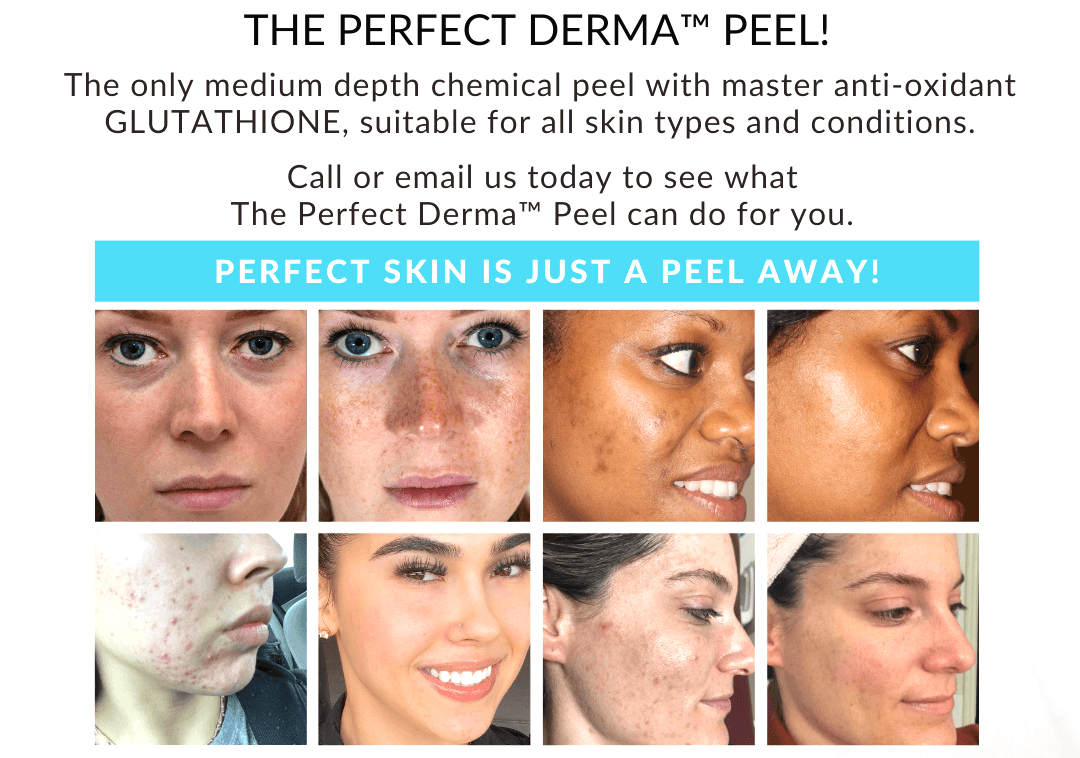 Facial Peel | Derma Peel | Chemical Peel South Gate,CA