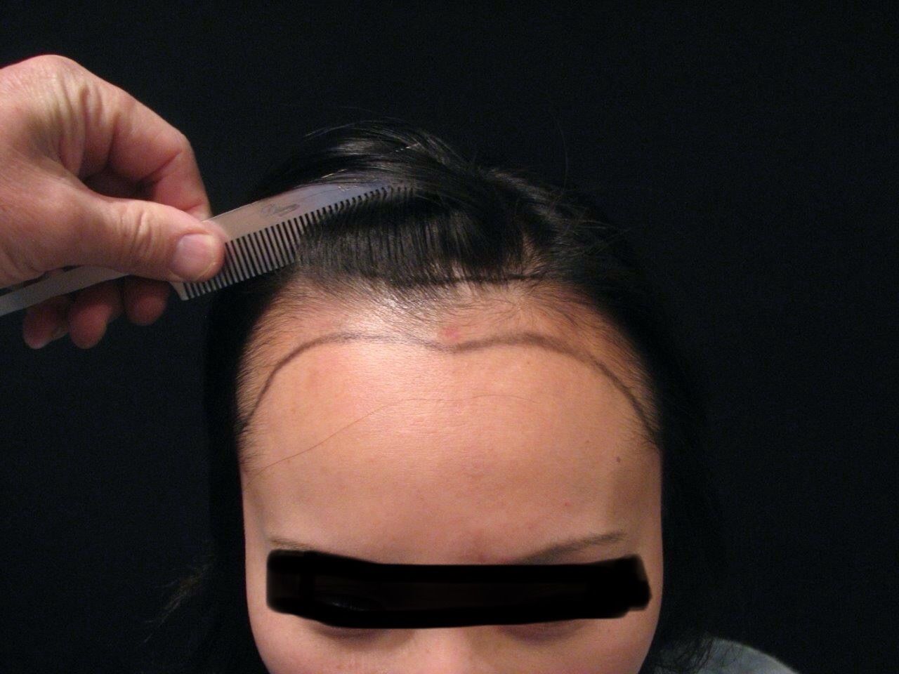 Before and After | Dr. Paul Cotterill