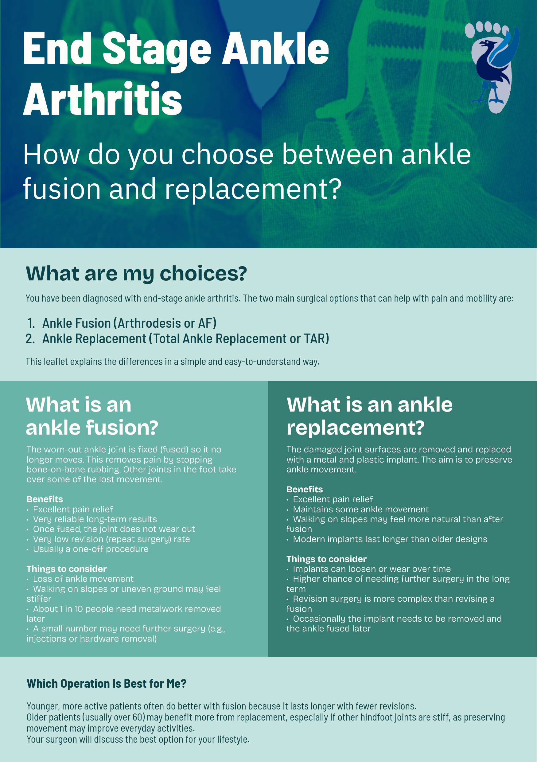Ankle Arthritis Information Updated