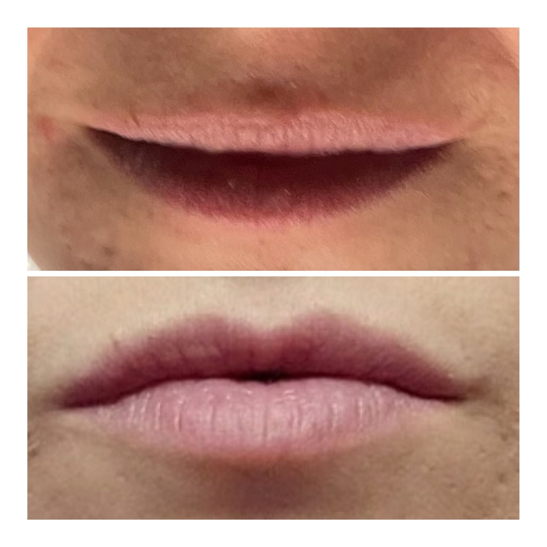 Gallery | Jackson, TN | Radiance Esthetics & Med Spa