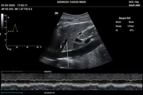 Preferred Medical | Trusted Ultrasound Imaging Solutions for Women's ...