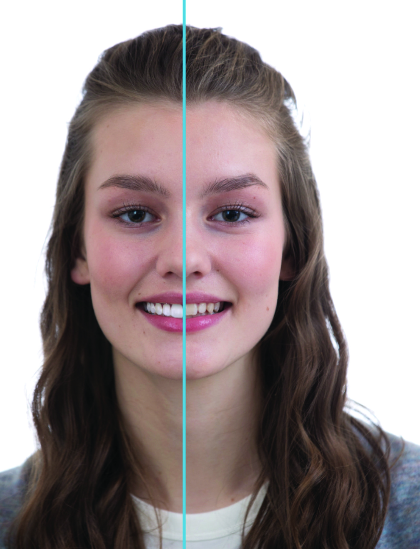 Digital Design | Cosmetic Dental Design | Australia