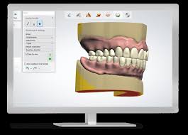Digital Design | Cosmetic Dental Design | Australia