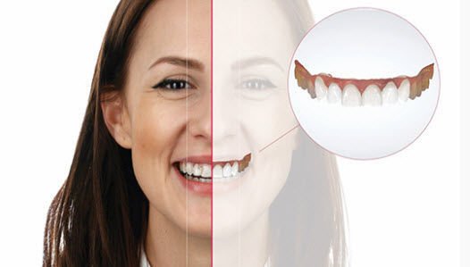 Digital Design | Cosmetic Dental Design | Australia