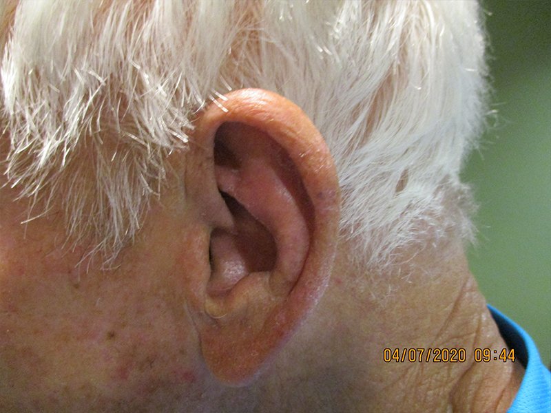 Skin Cancers | Southwest Oncology Centers