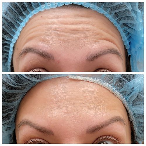 Beach Periodontal, Dental Implants & Med Spa Rochester NY 14626