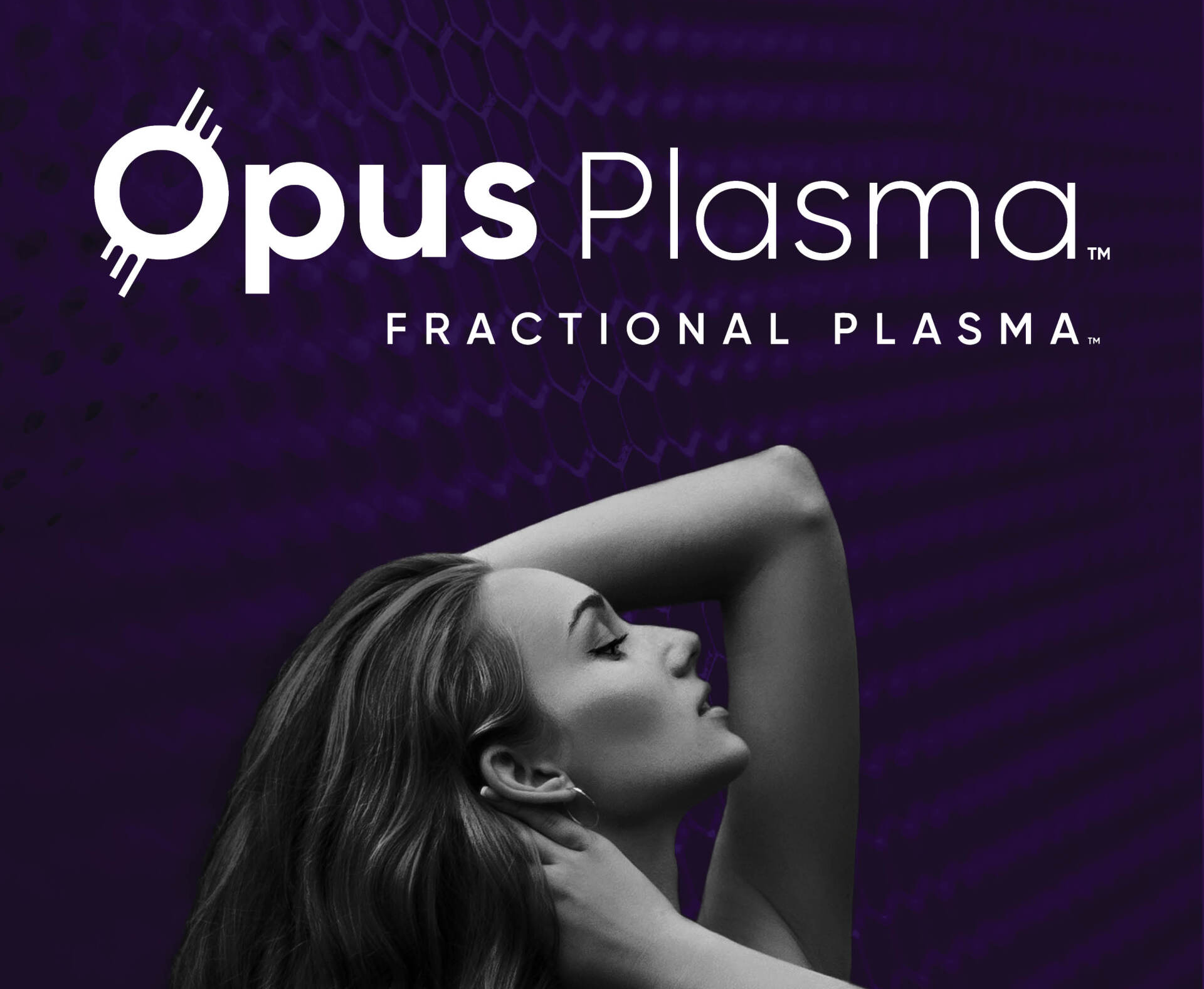 Opus Plasma Skin Resurfacing | Artistic Spa
