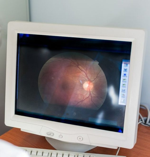 Cataracts in Lake Macquarie | Ian Emslie Optometrist