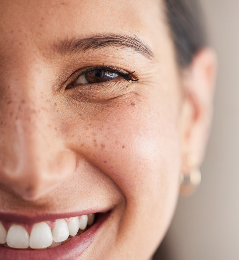 IPL Treatment | Bloom Rejuv in North Reading, MA