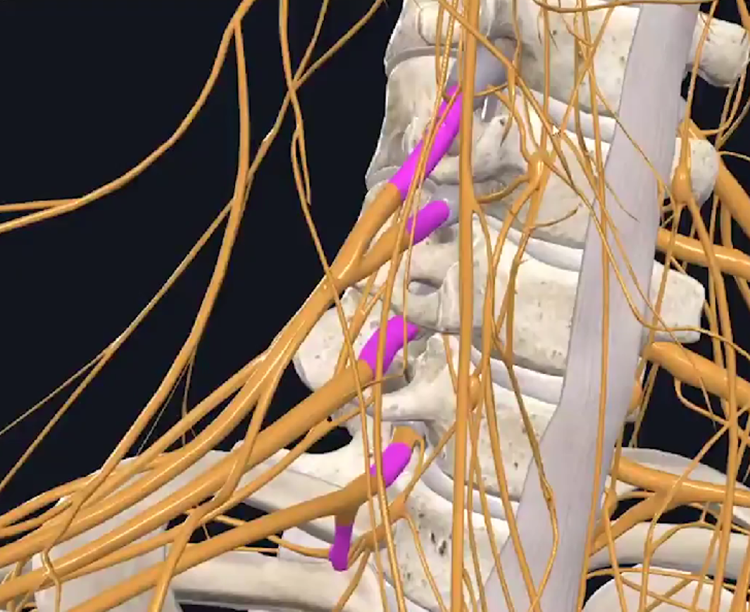 Cirurgia de Plexo Braquial: O Momento mais Importante da sua vida