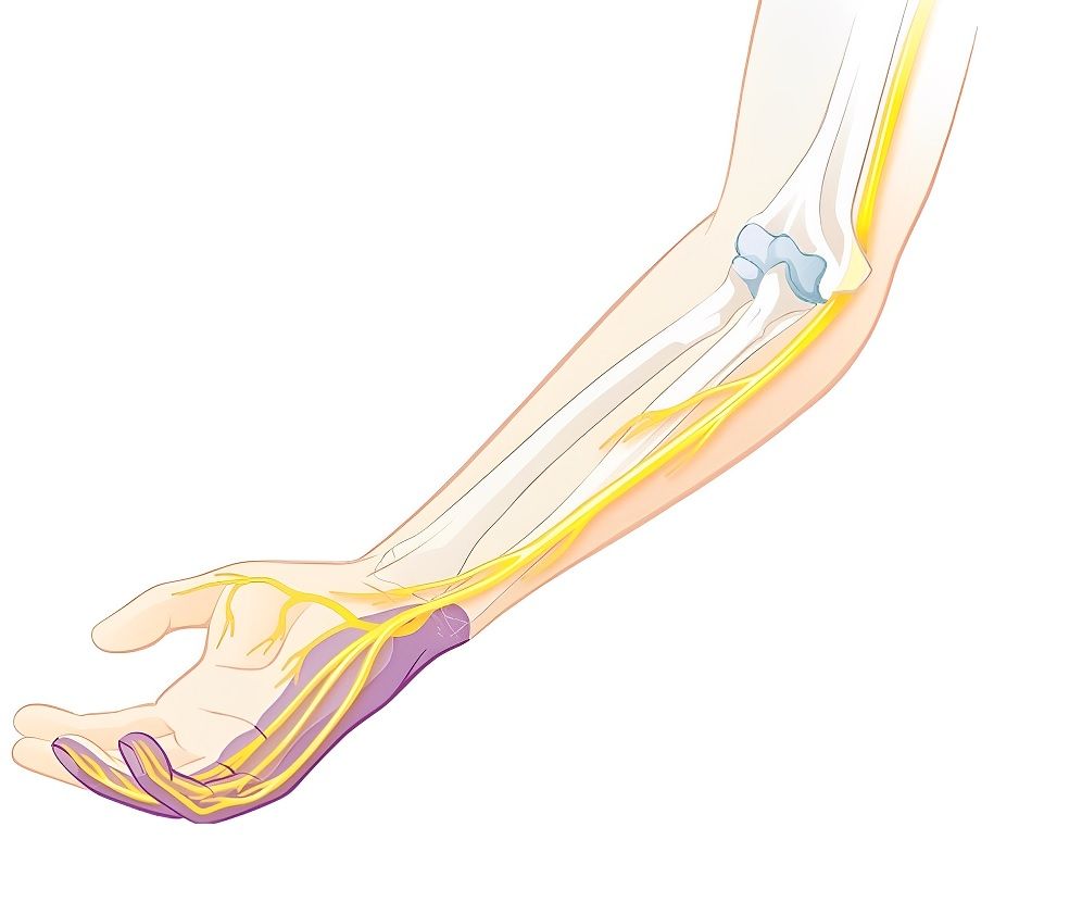 Lesão do Nervo Ulnar: Tudo O que Você Precisa Saber