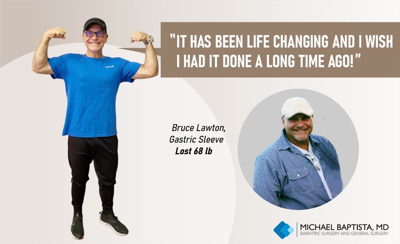 Bruce Lawton, Gastric Sleeve Lost 68 lbs!