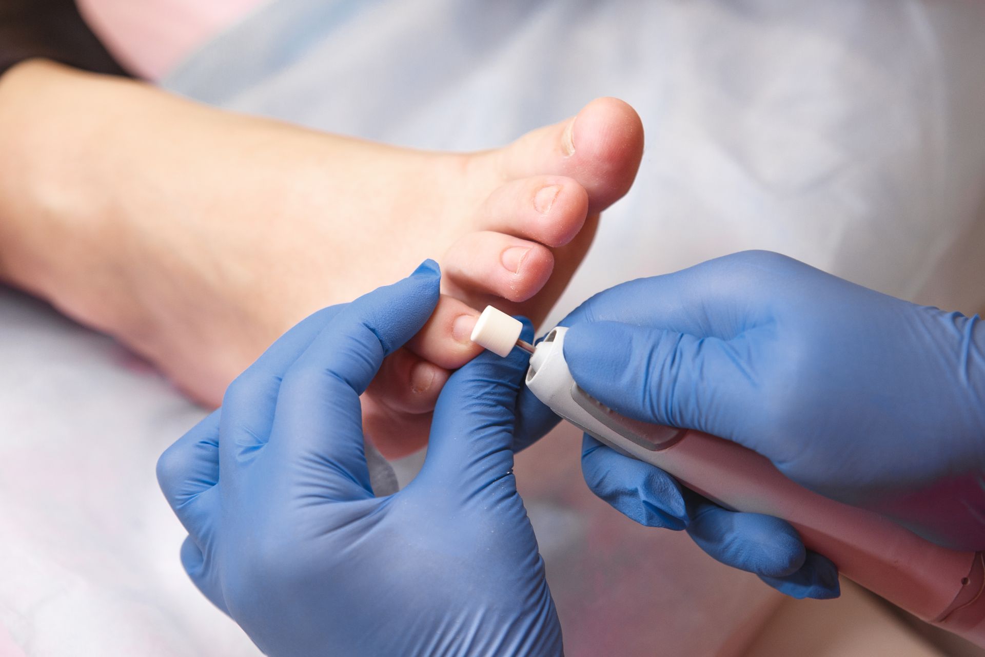 Prosthetic Toenail Service | Healthy Happy Feet