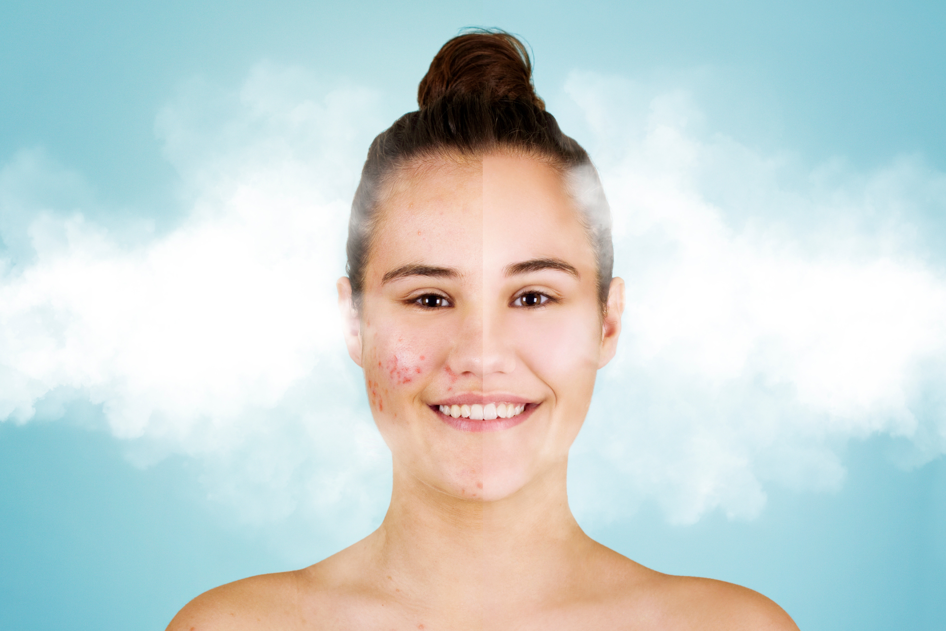 How to Care for Your Skin After Cryosurgery: Tips for a Smooth Recovery
