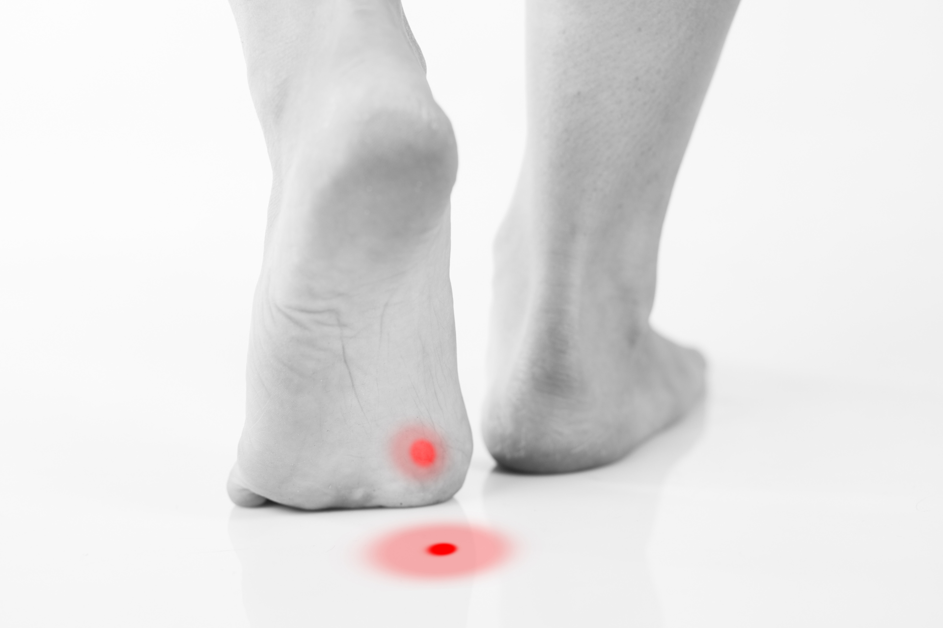 Warts vs. Corns: How to Tell the Difference and Choose the Right Treatment