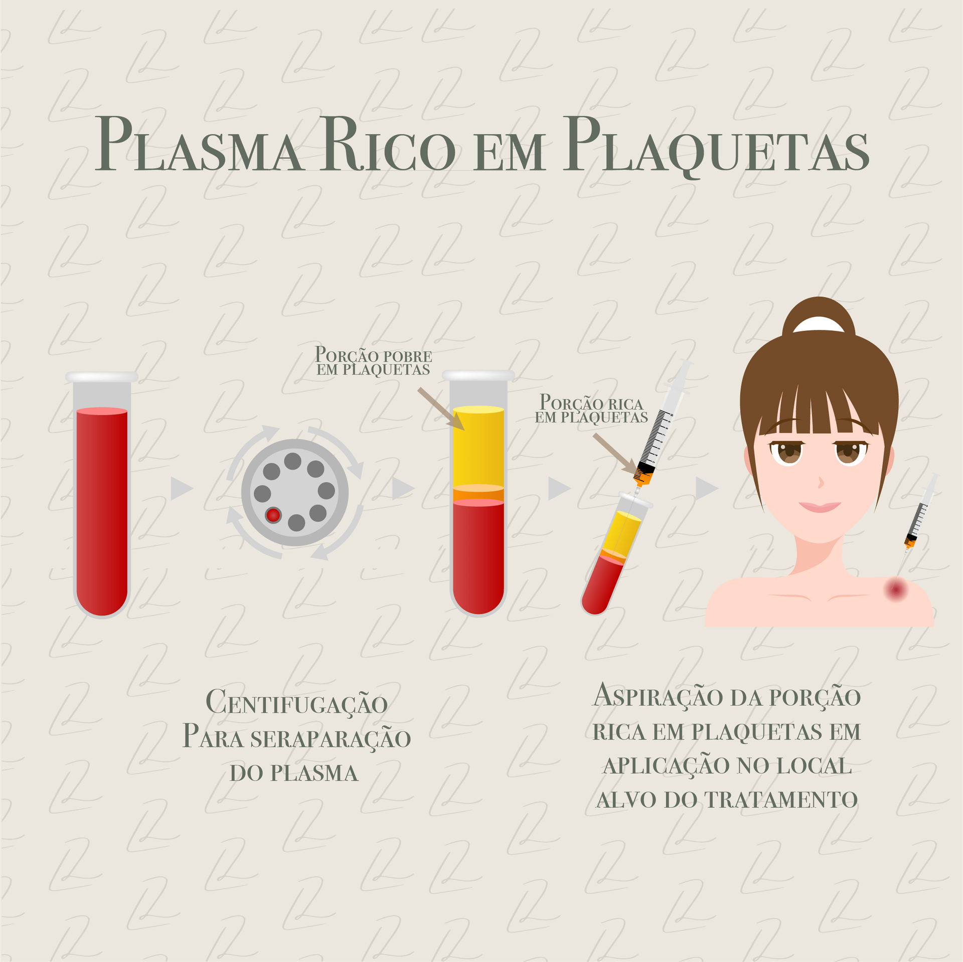 O que é o Plasma Rico em Plaquetas (PRP)? Uma Visão Geral