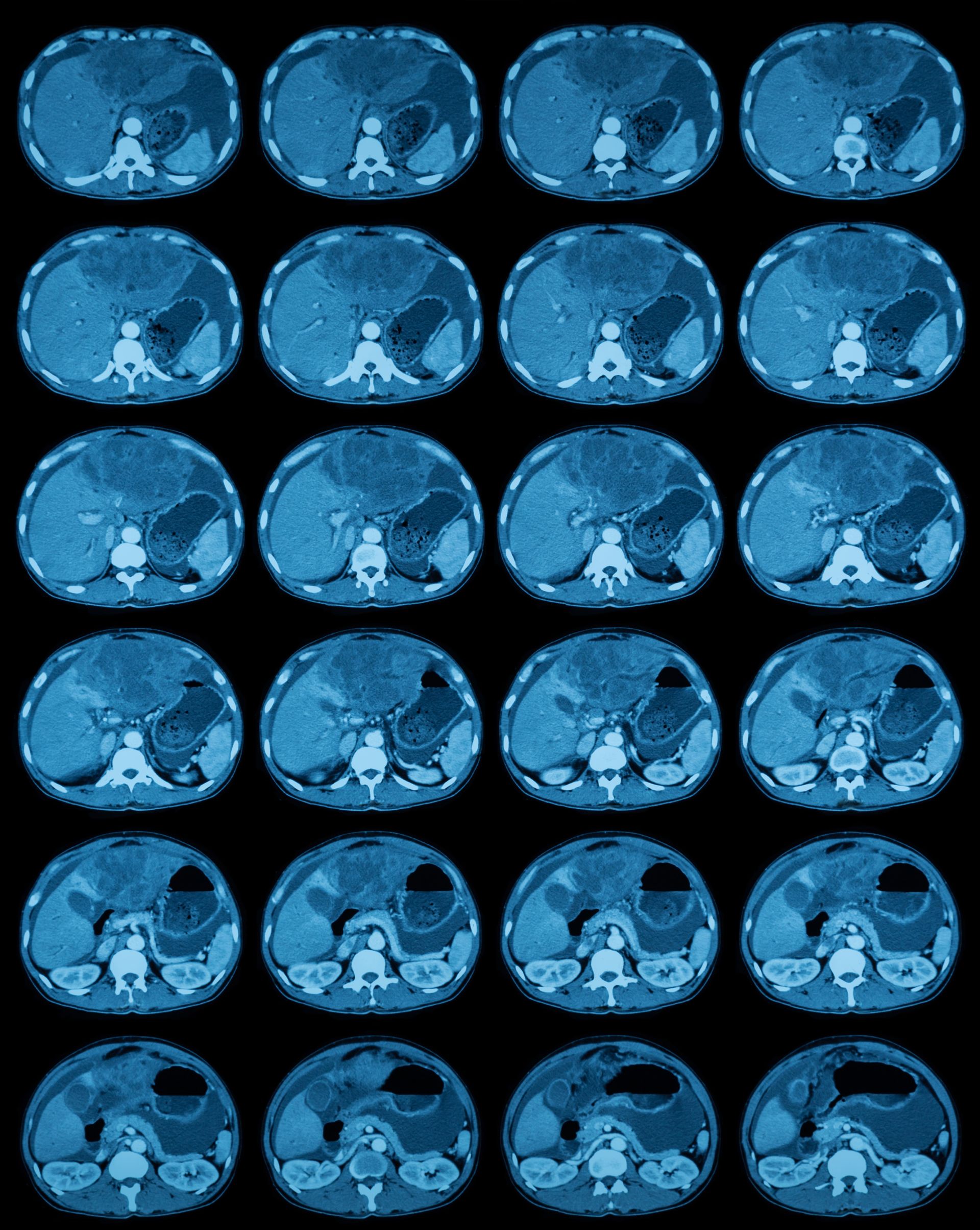 Private Imaging Center, Heart, Lung, Full Body Scan & Virtual ...