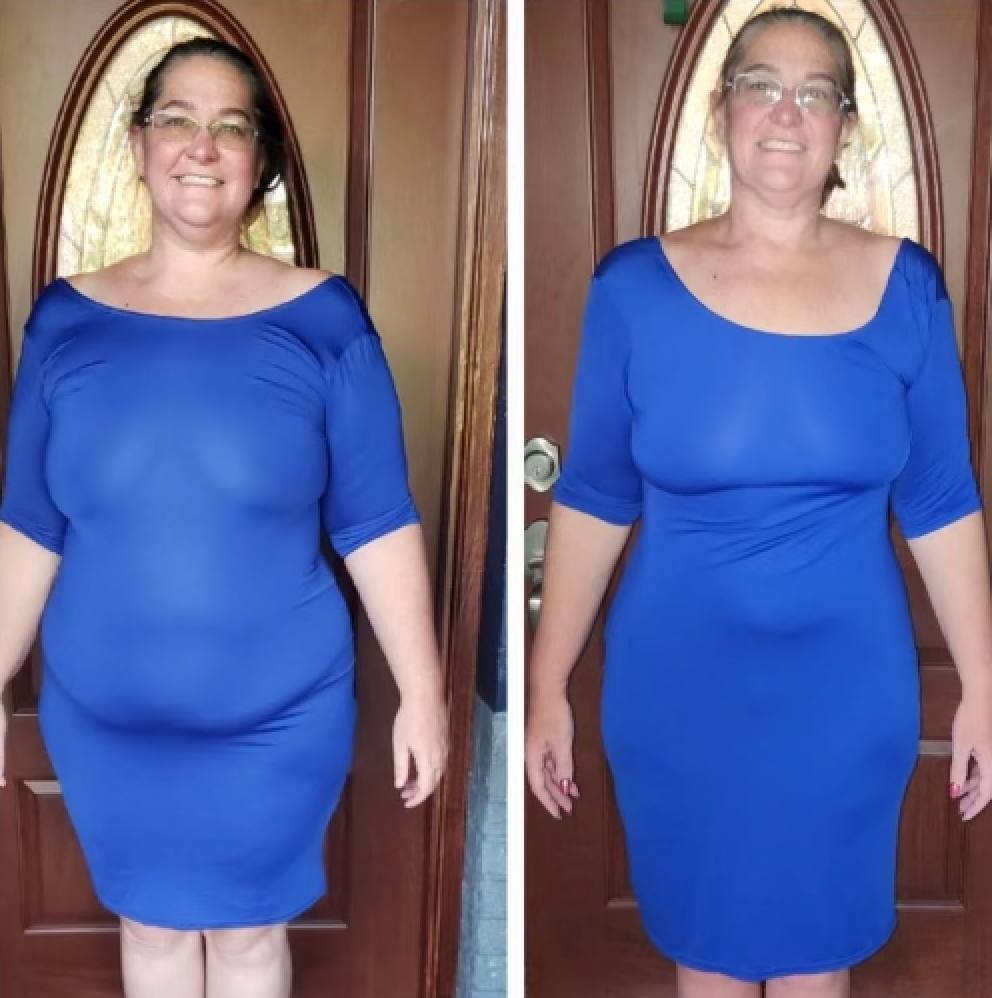 Age is Just a Number with Cryoslimming | Ultra Cryo & Recovery