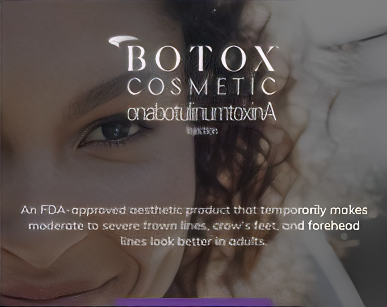 Botox – Everything you need to know!