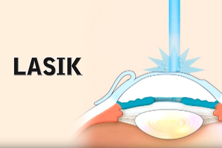 Videos | Helm Vision Group