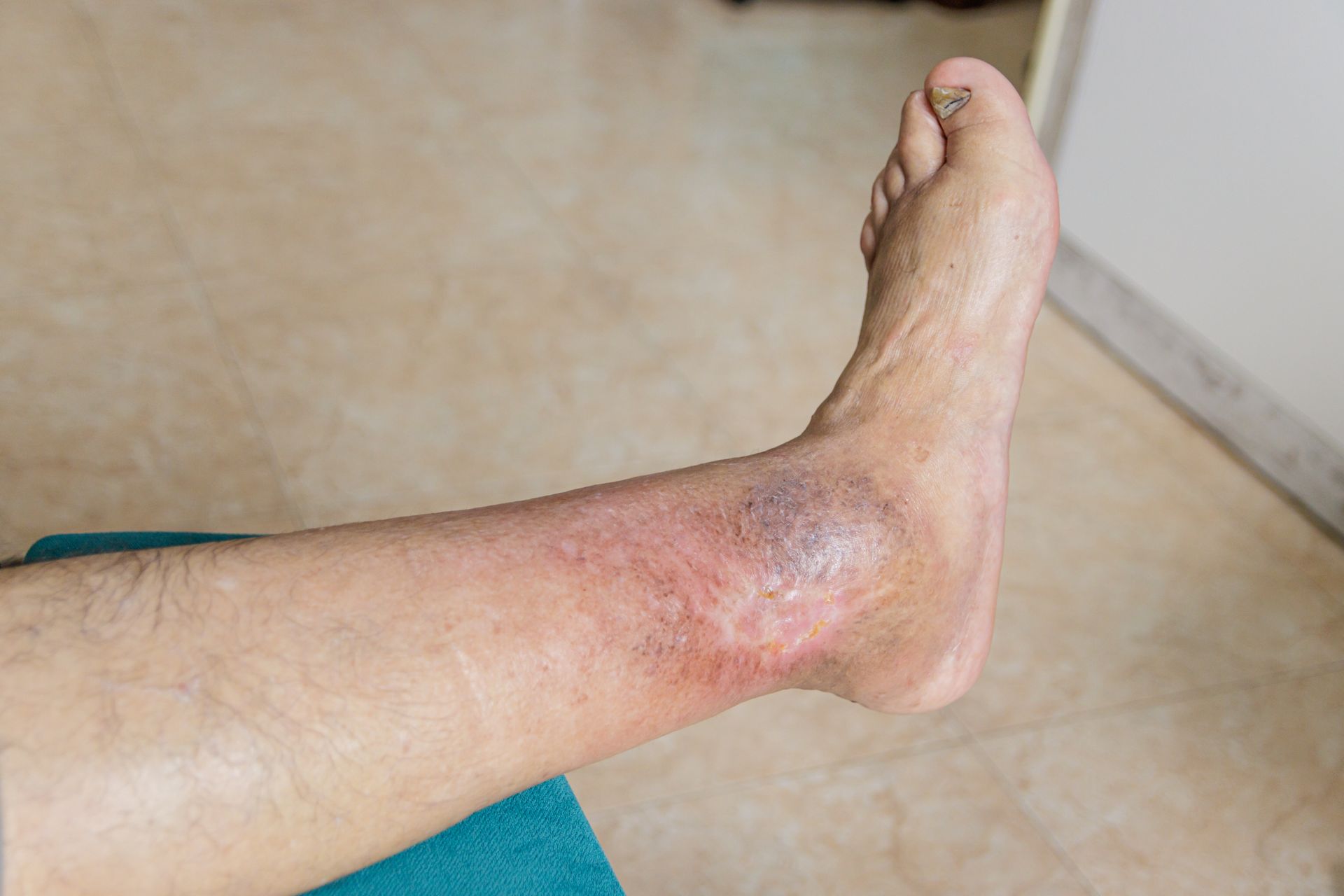 7 Tips Para Mejorar La Circulación De Las Piernas 4912
