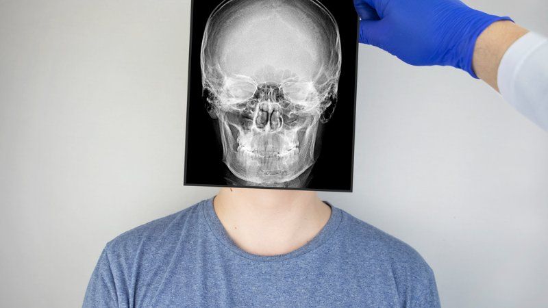 What Is the Eggshell Skull Rule?