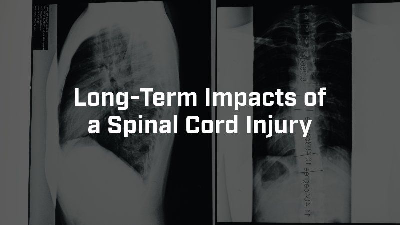 Long-Term Impacts of a Spinal Cord Injury