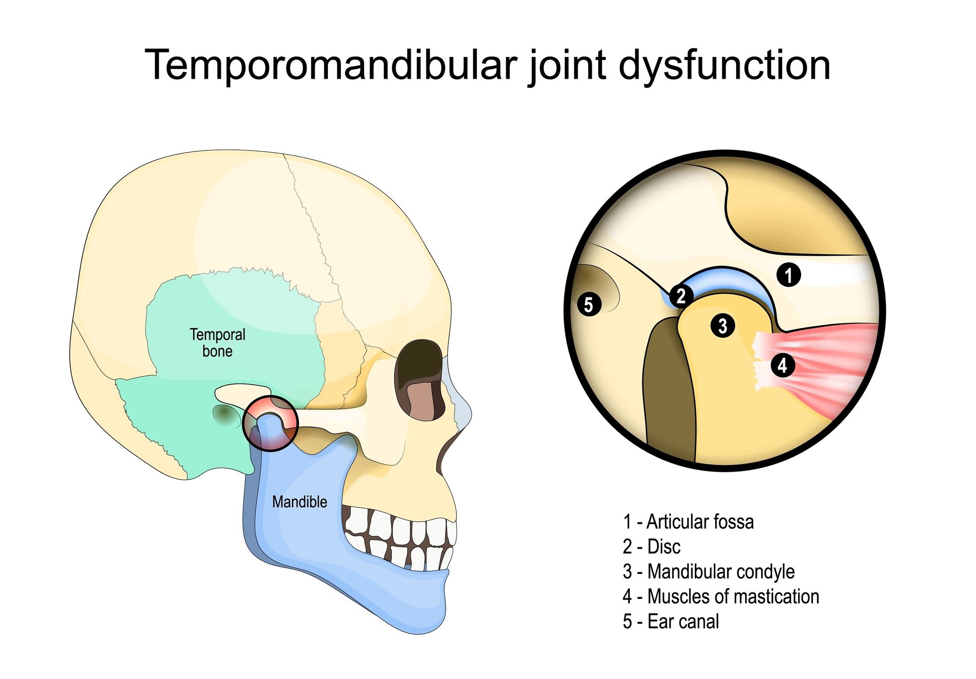 Understanding TMJ/TMD