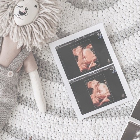 Ultrasound Scan Studios | Meet Your Miracle Studios