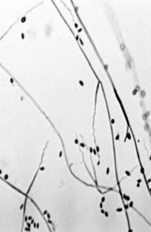 Mold Library | North, Central & South FL 🍊 | Mold Masters 🦠