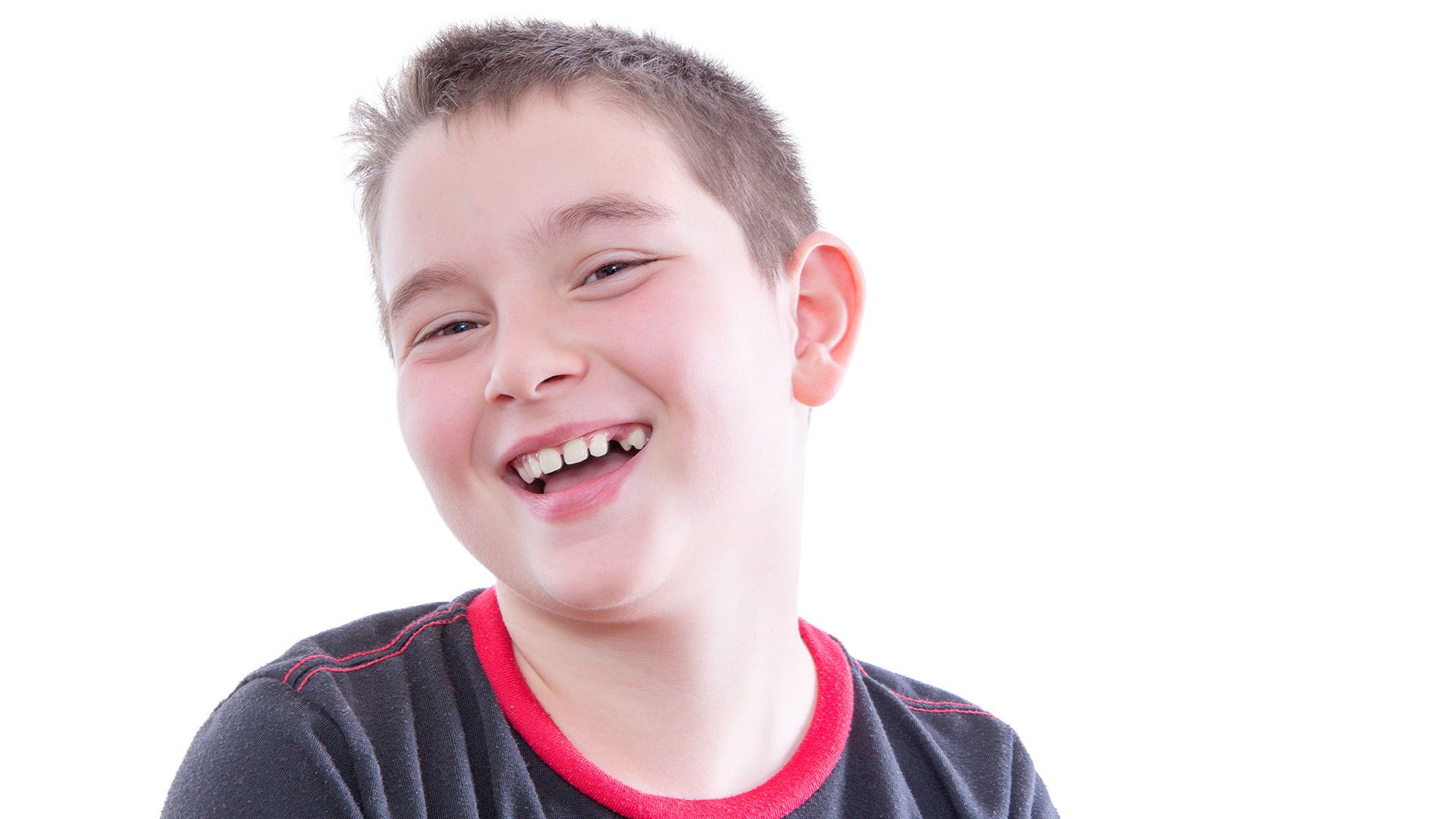 Can You Get Braces with Missing Teeth? What to Know