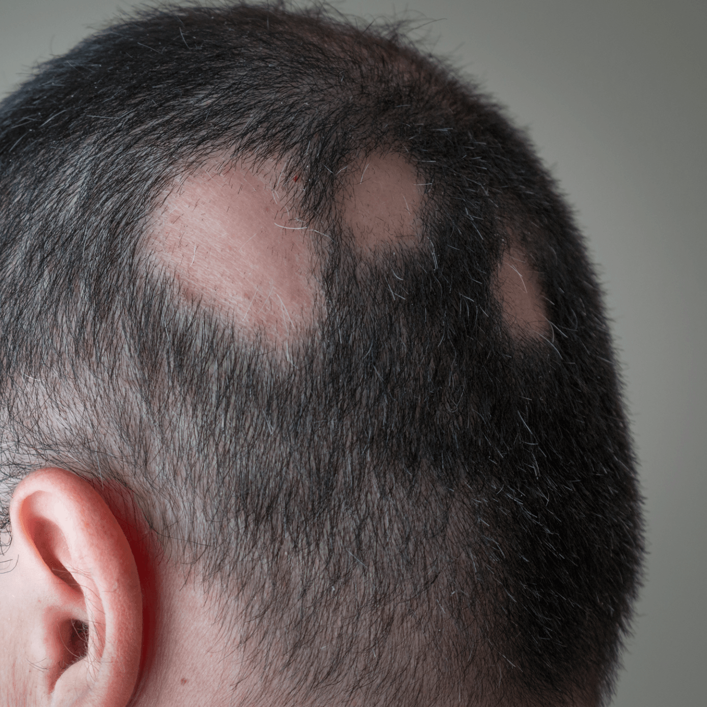 Current Studies | Dermatology Research Institute | Encinitas, CA