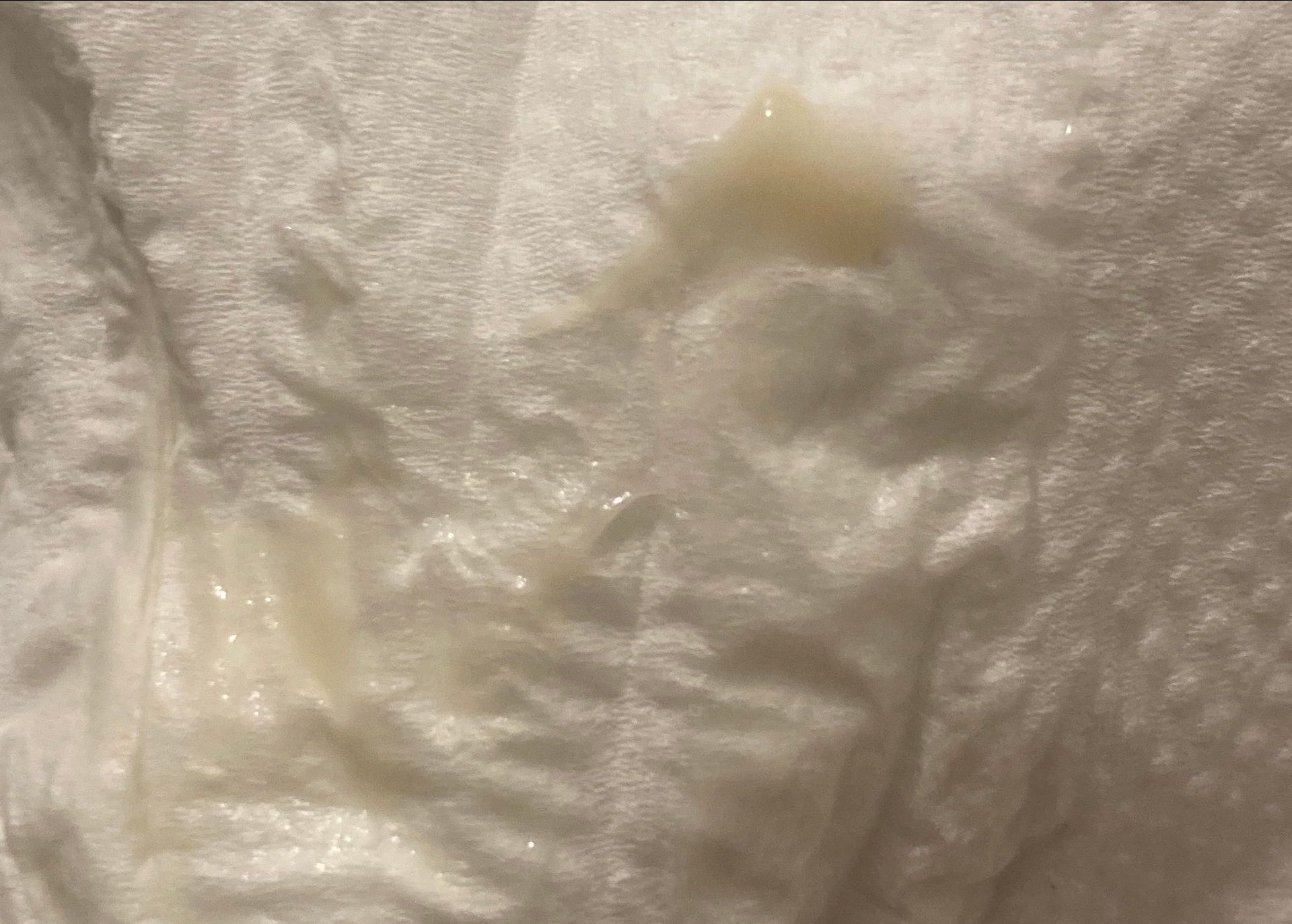 Guide to Cervical Mucus (with Pictures)