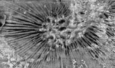 Malattie e chirurgia macula