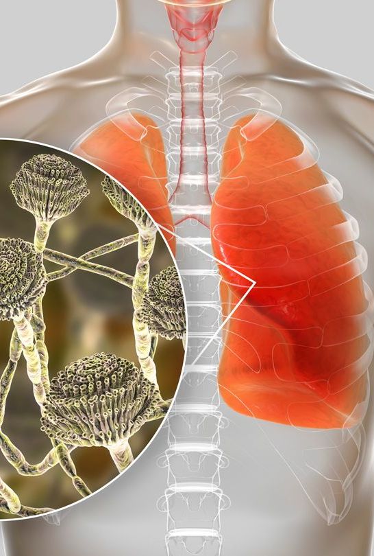 CIRS Mold Sickness Diagnosis & Treatment in Orlando, FL | Whole Family ...