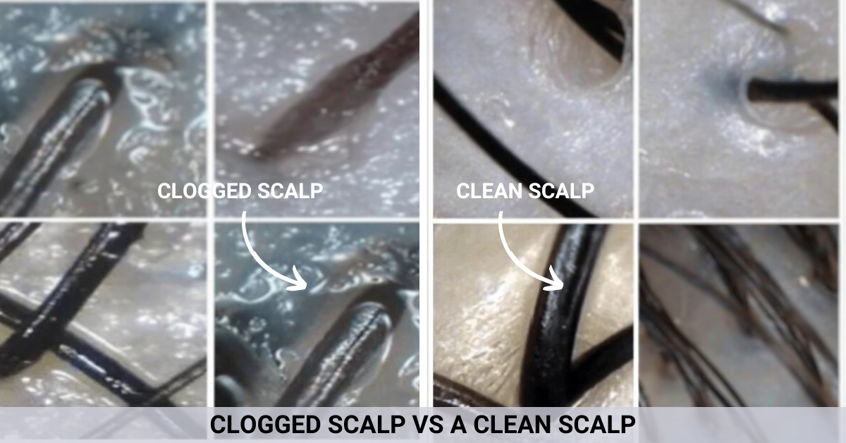 Hair Treatments in Our Hair Salon in Singapore