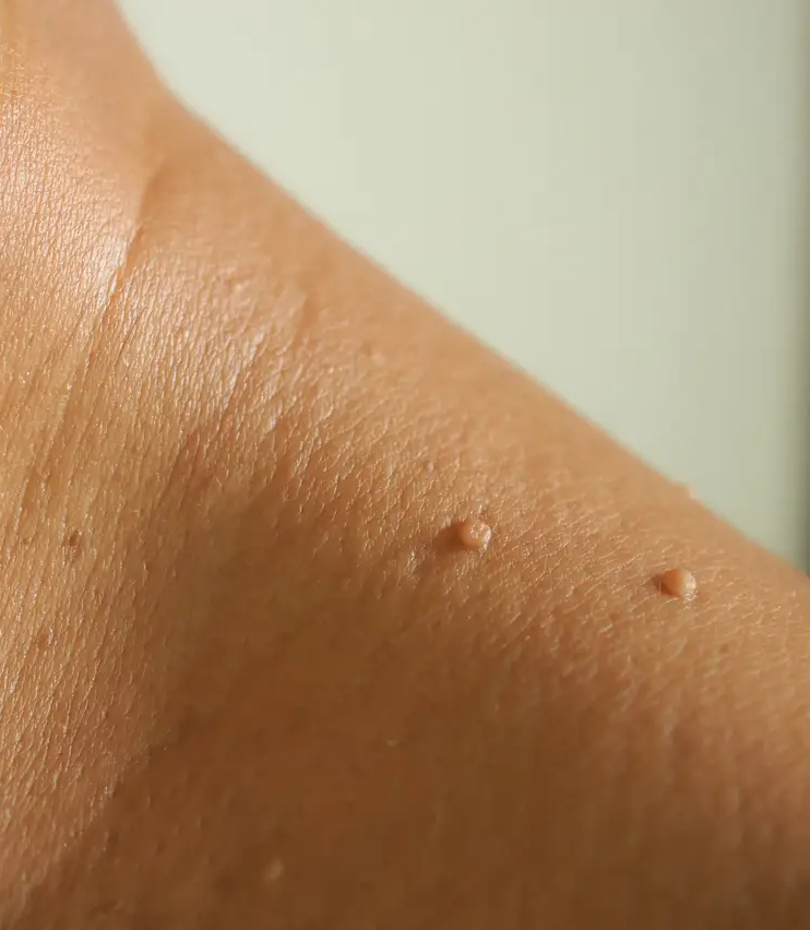 Superficial Skin Condition Treatments by Anti Aging Clinic