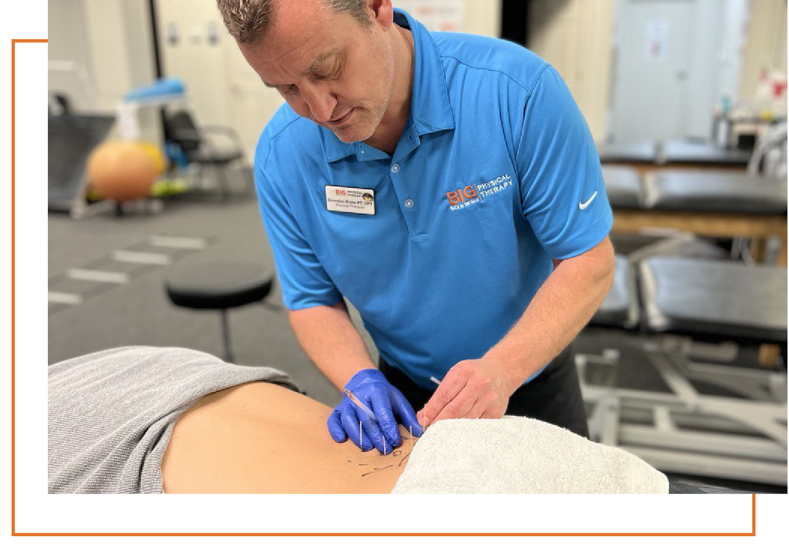Dry Needling Therapy Dacula, GA