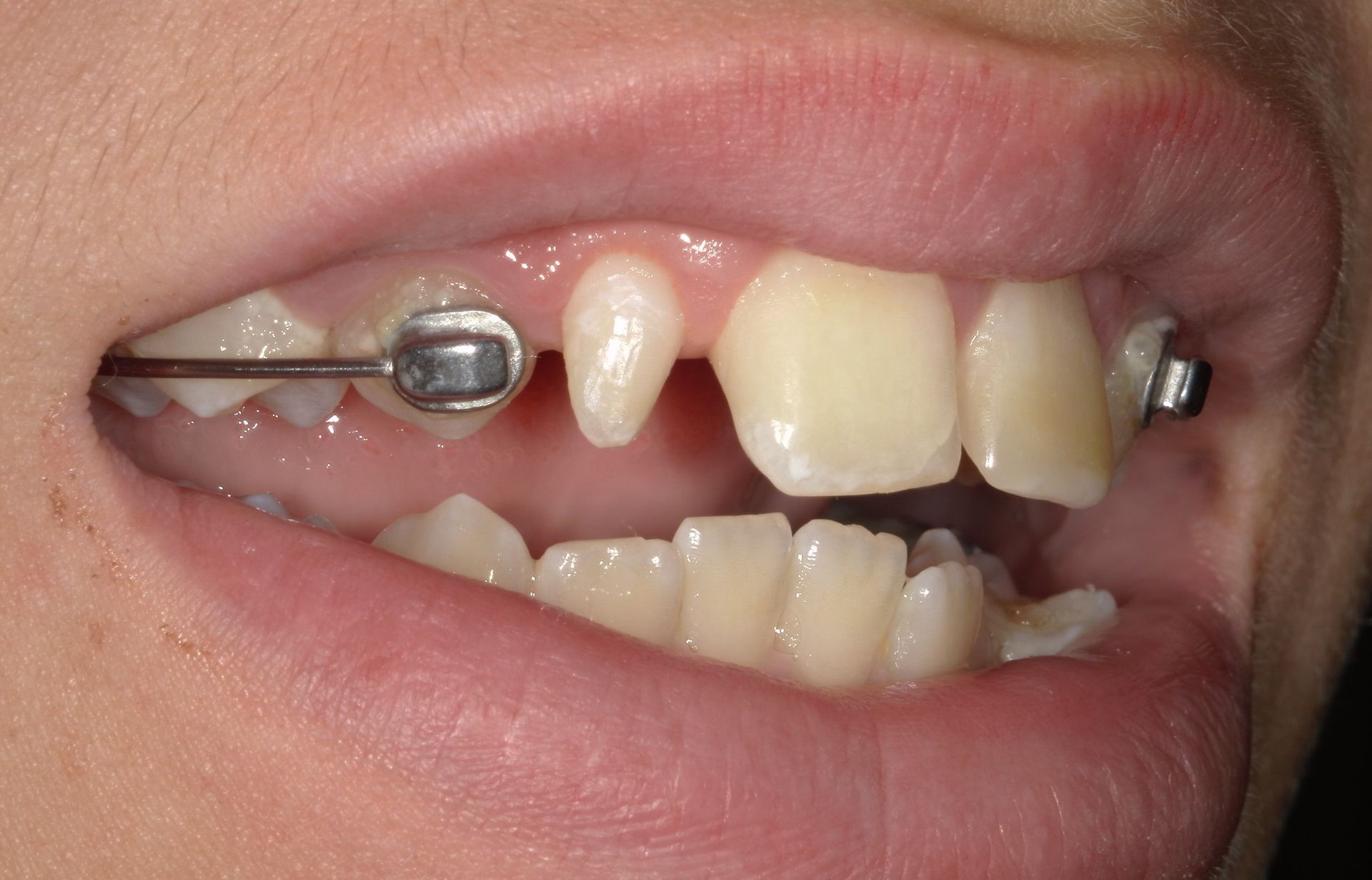 Testimonials | Tustin, CA | Michael Yang, DDS INC