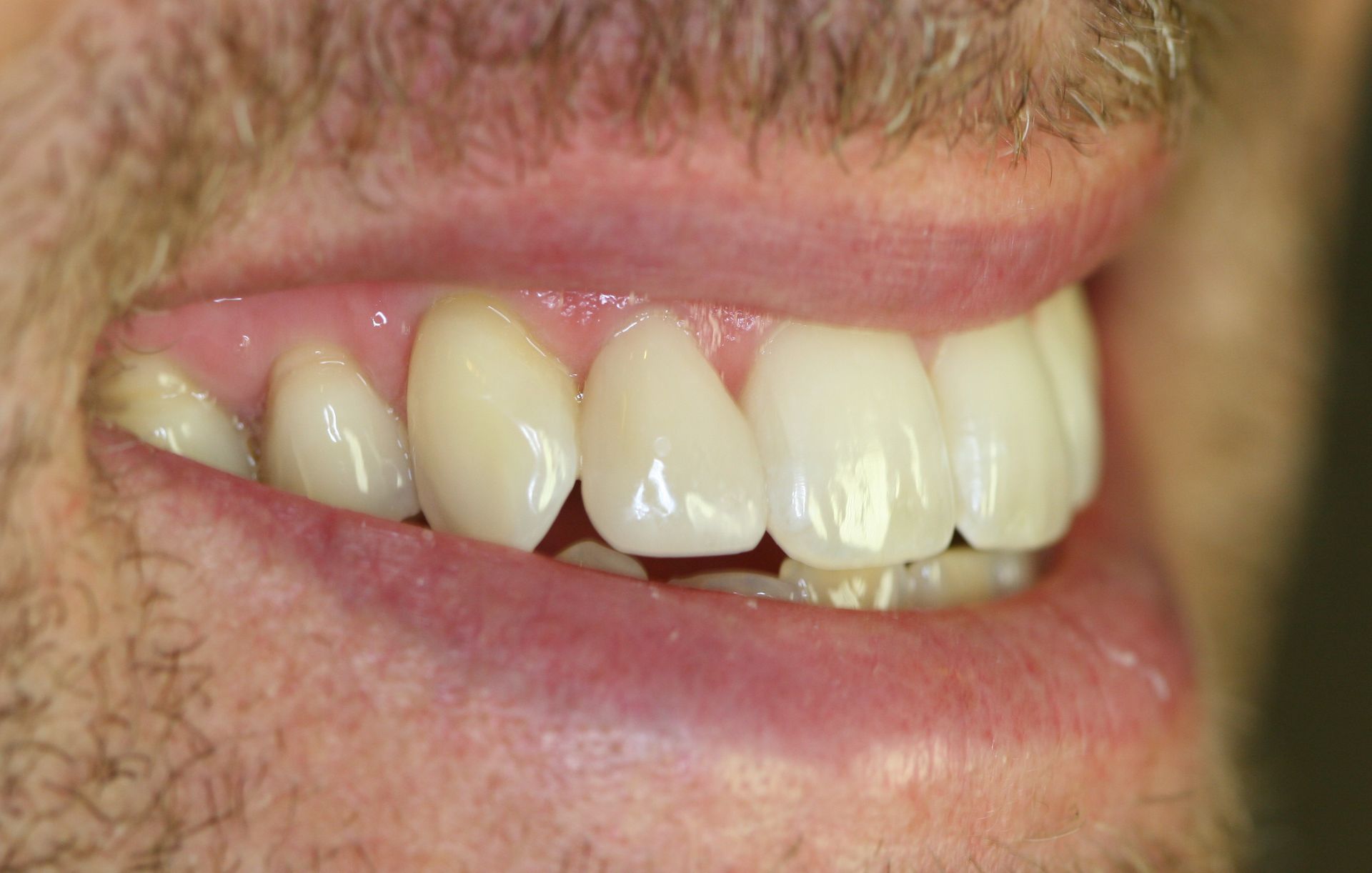 Testimonials | Tustin, CA | Michael Yang, DDS INC