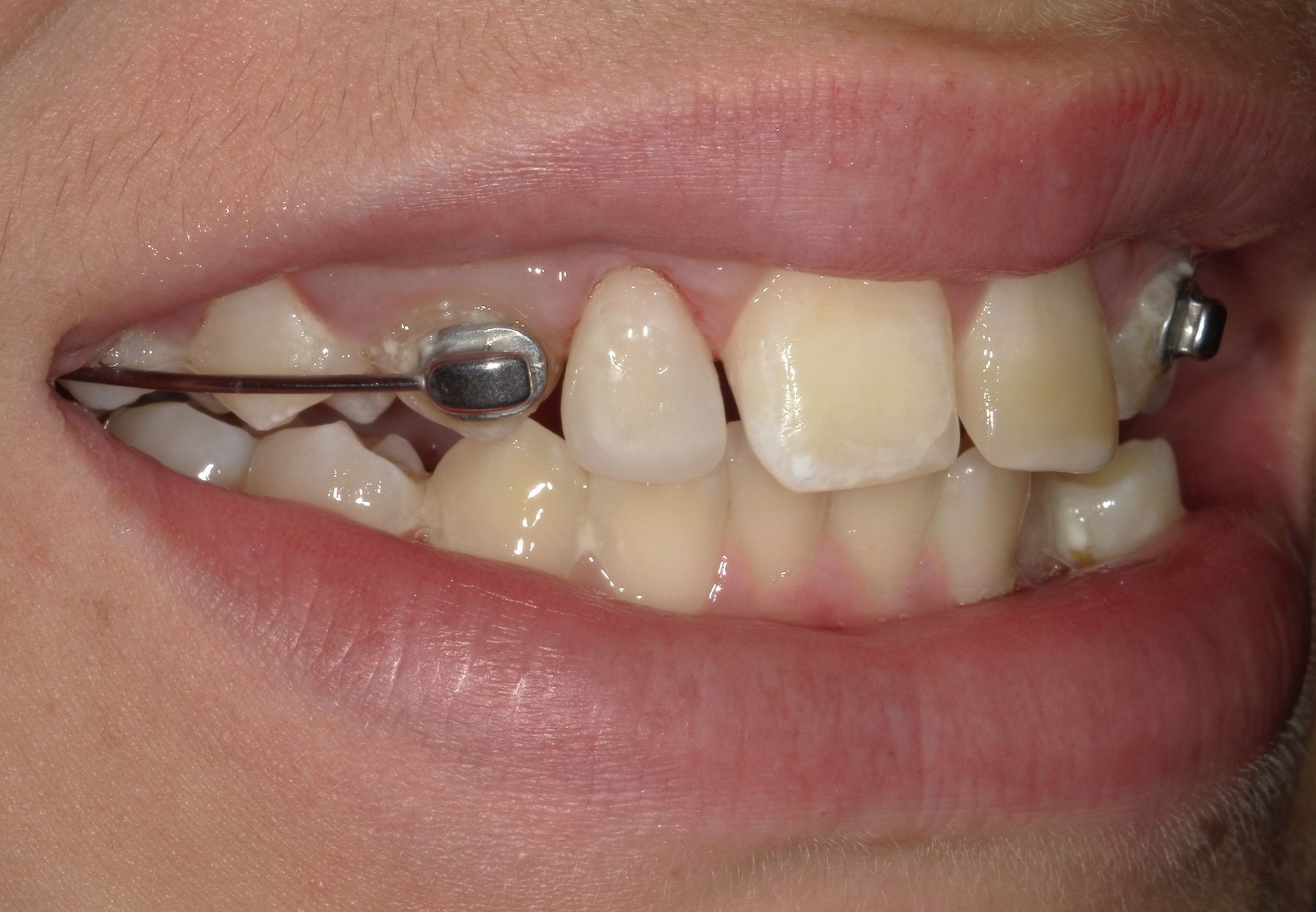 Testimonials | Tustin, CA | Michael Yang, DDS INC