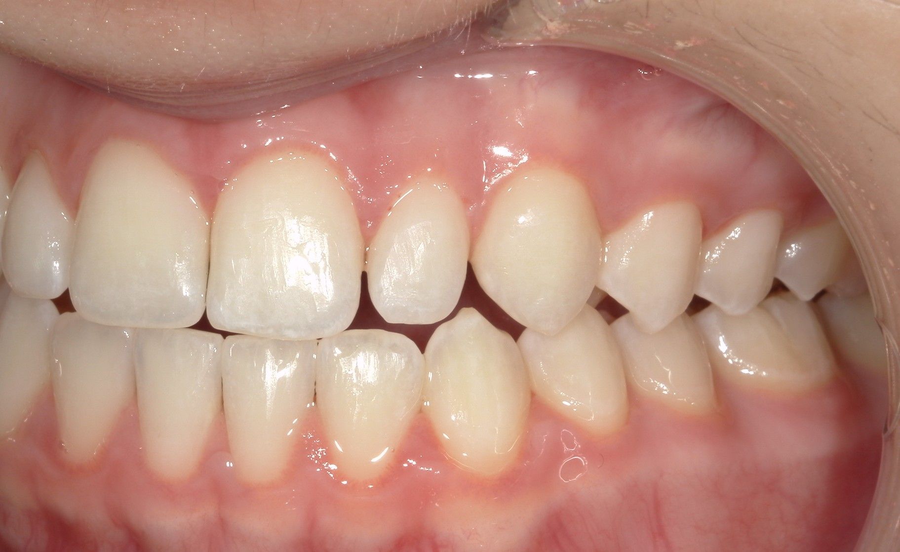 Testimonials | Tustin, CA | Michael Yang, DDS INC