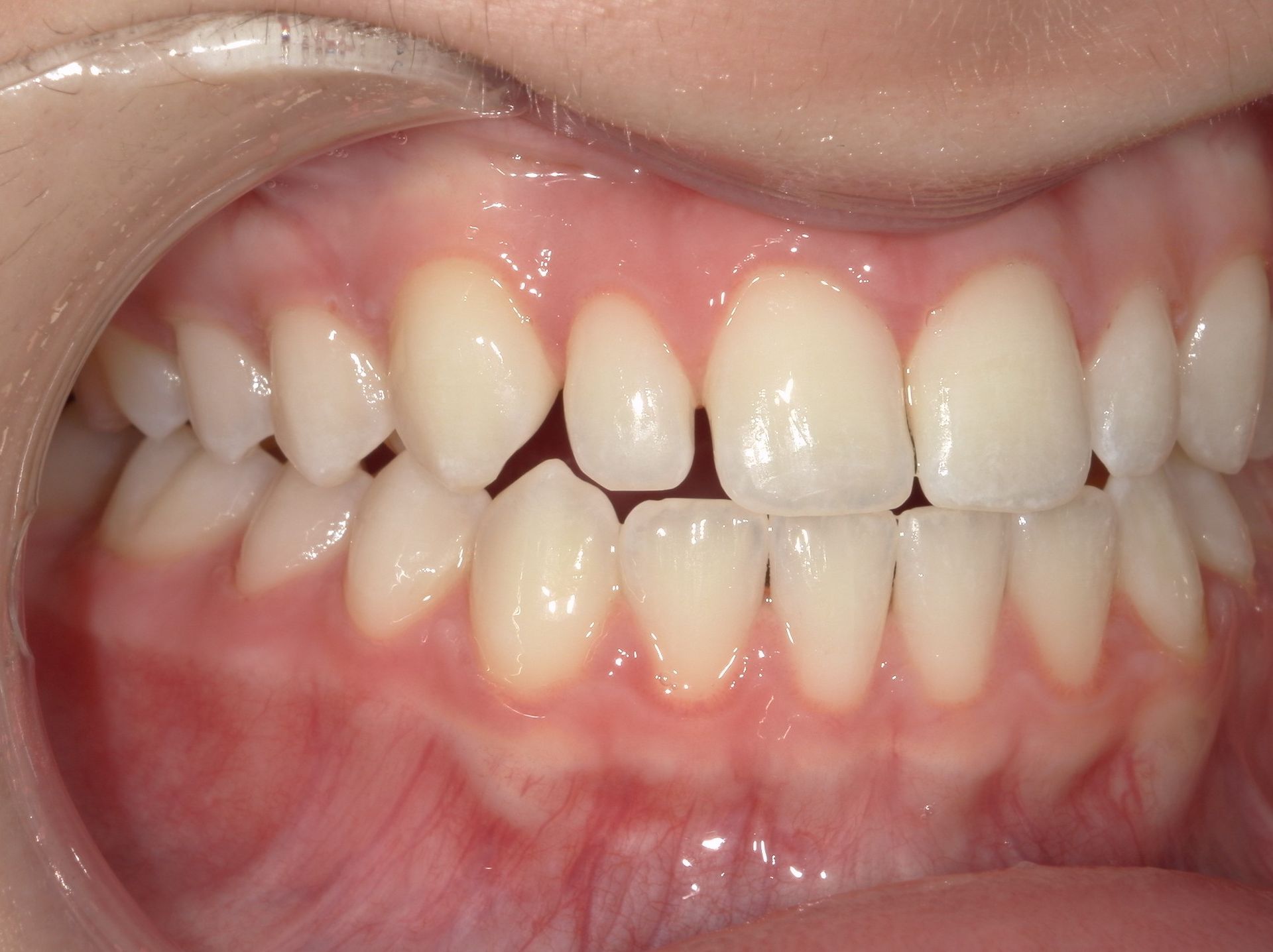Testimonials | Tustin, CA | Michael Yang, DDS INC