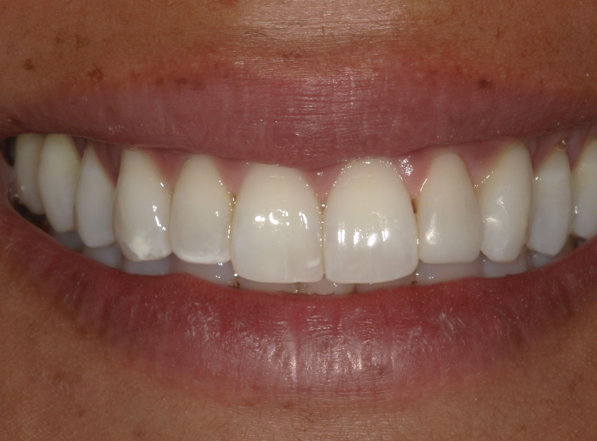 Testimonials | Tustin, CA | Michael Yang, DDS INC