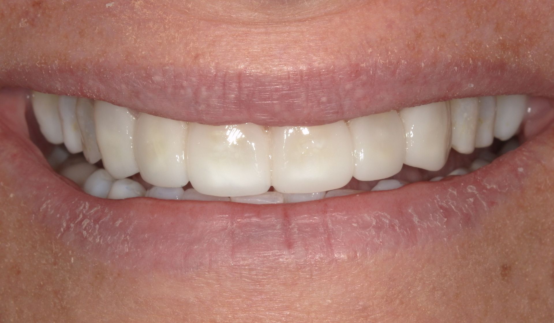 Testimonials | Tustin, CA | Michael Yang, DDS INC
