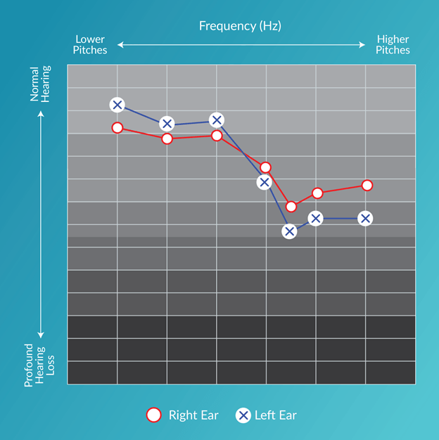 How Hearing is Measured