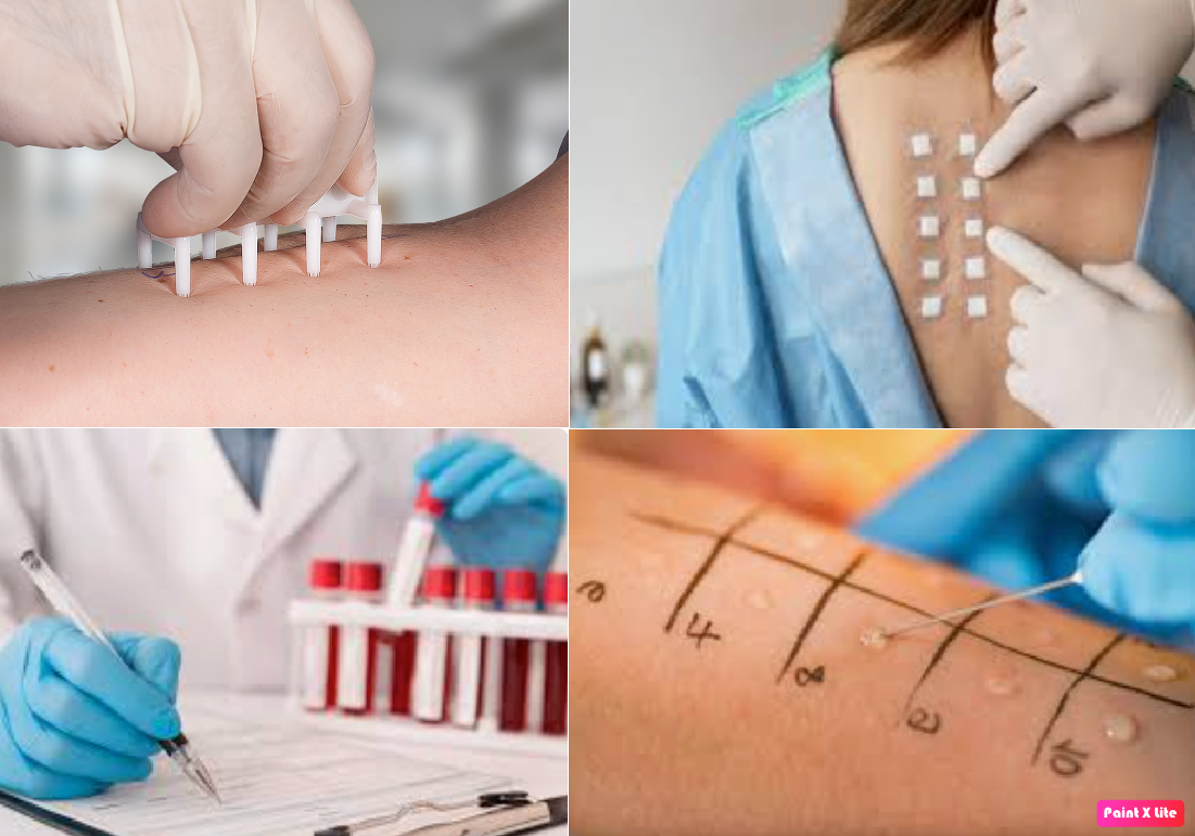 Quais opções você tem para descobrir se tem alguma alergia