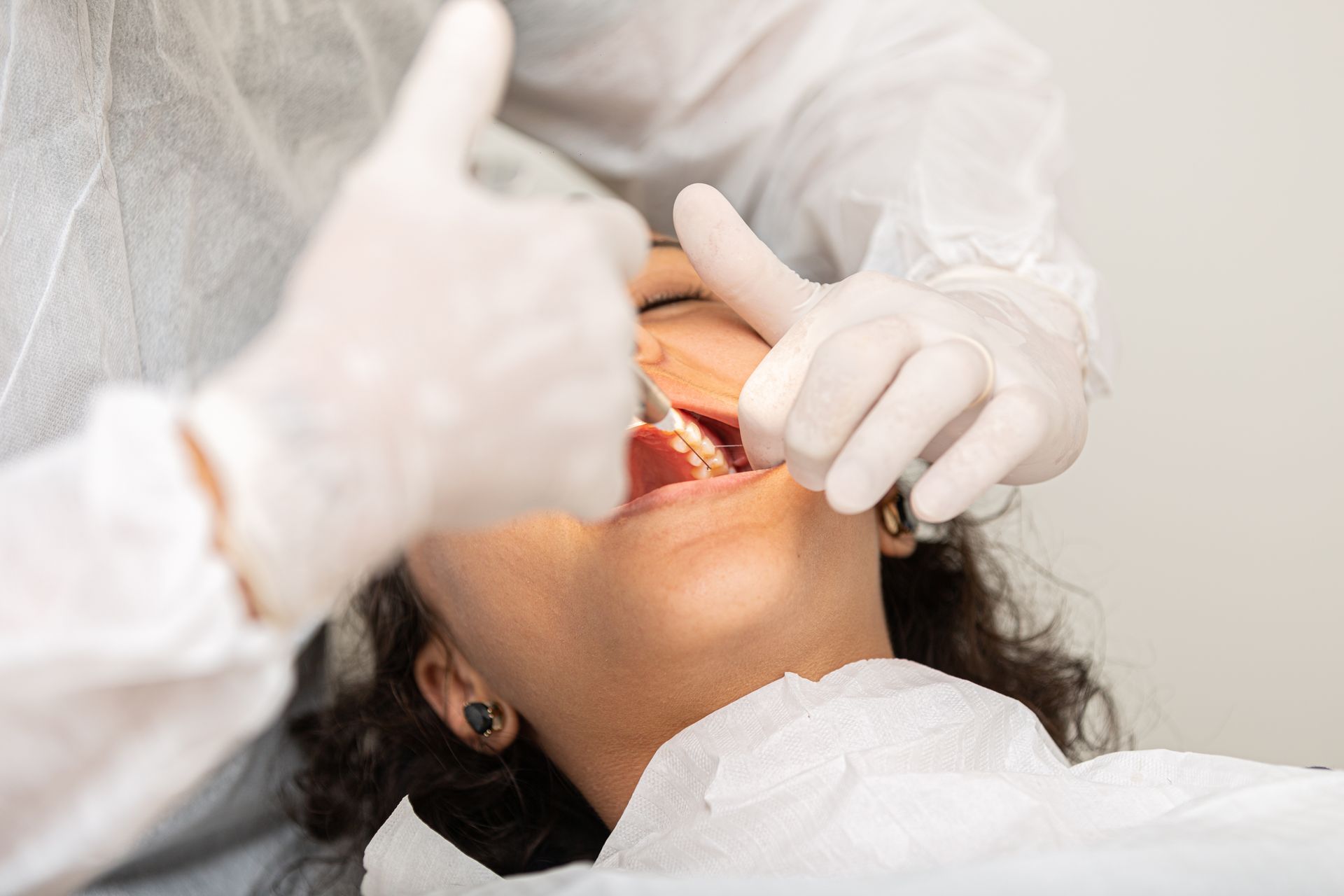 Wisdom Tooth Extractions: What to Expect Before and After Surgery