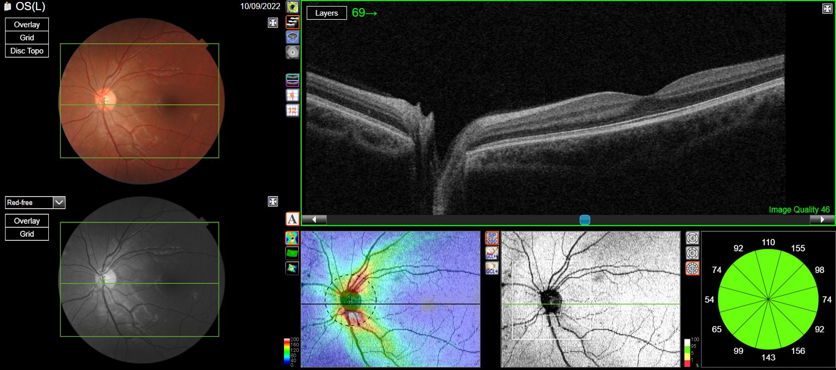 Jones Opticians | Eye Care and Eyewear Since 1956