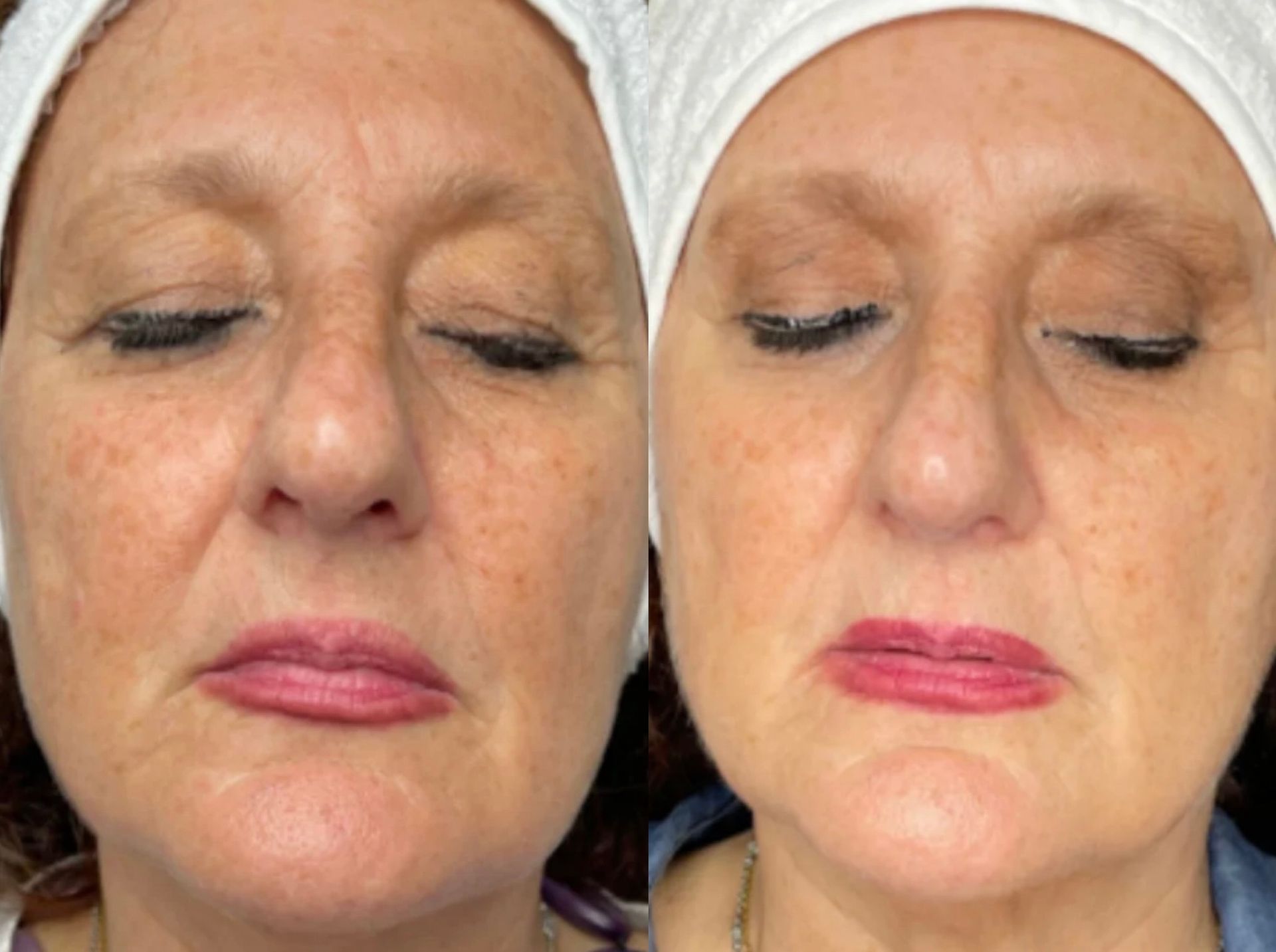 PRX-PLUS Townsville | Townsville Anti Aging